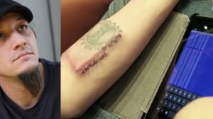 Biohacker impianta un sensore nel suo braccio