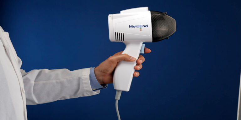 MelaFind: lo scanner ottico in grado di rilevare melanomi in modo non ...