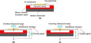 Butterfly iQ: la tecnologia ad ultrasuoni su chip che rivoluzionerà la ...