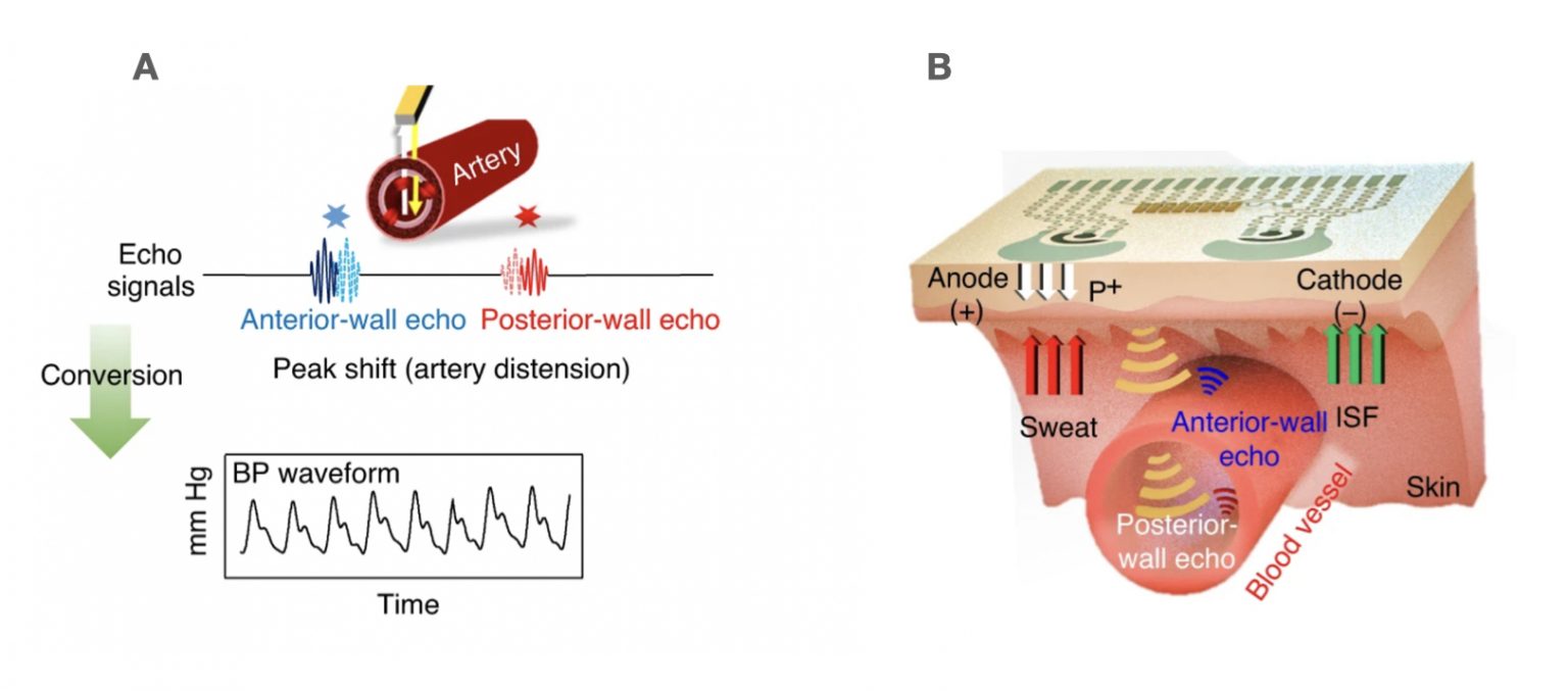 Nuovo sensore all-in-one: un cerotto epidermico monitora la salute