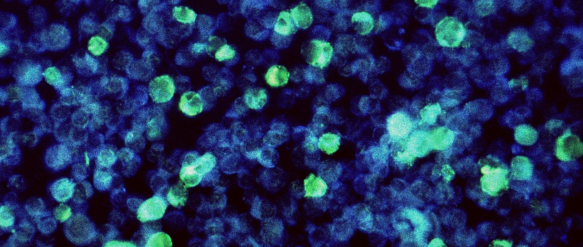 Gli esosomi, una strategia antitumorale di frontiera