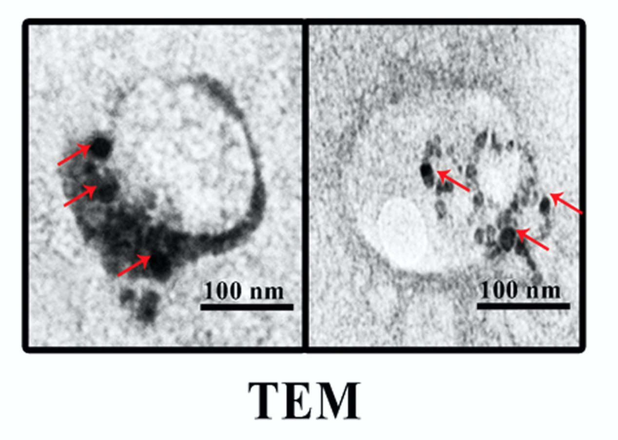 Gli esosomi, una strategia antitumorale di frontiera