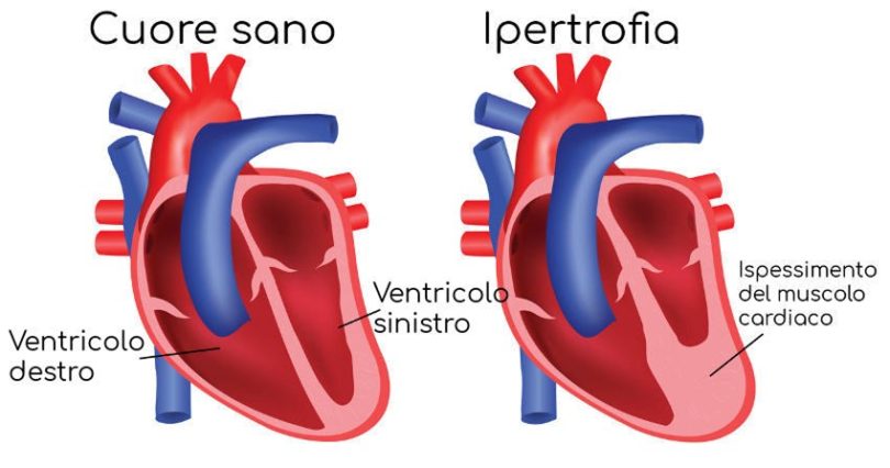 Lo sviluppo di organoidi riflette le patologie cardiovascolari: gli ...